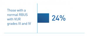 Diagnosing and Grading Vesicoureteral Reflux (VUR)